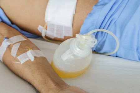 How To Manage The Wounds At The Drain Tube Sites, At Home? - Dr ...