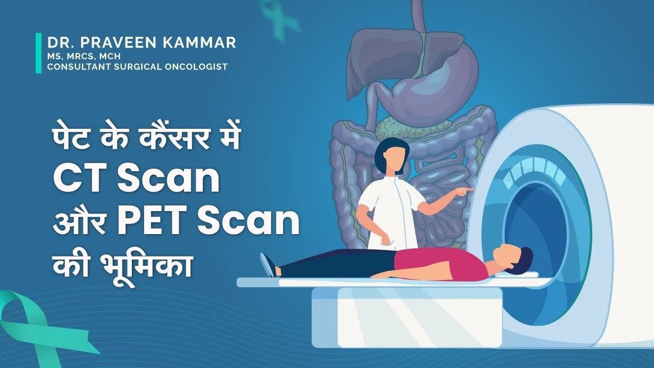 CT & PET Scan in Stomach Cancer: How To Confirm Stomach Cancer